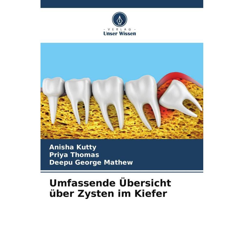 Unser Wissen Umfassende Übersicht über Zysten im Kiefer - Galaxus