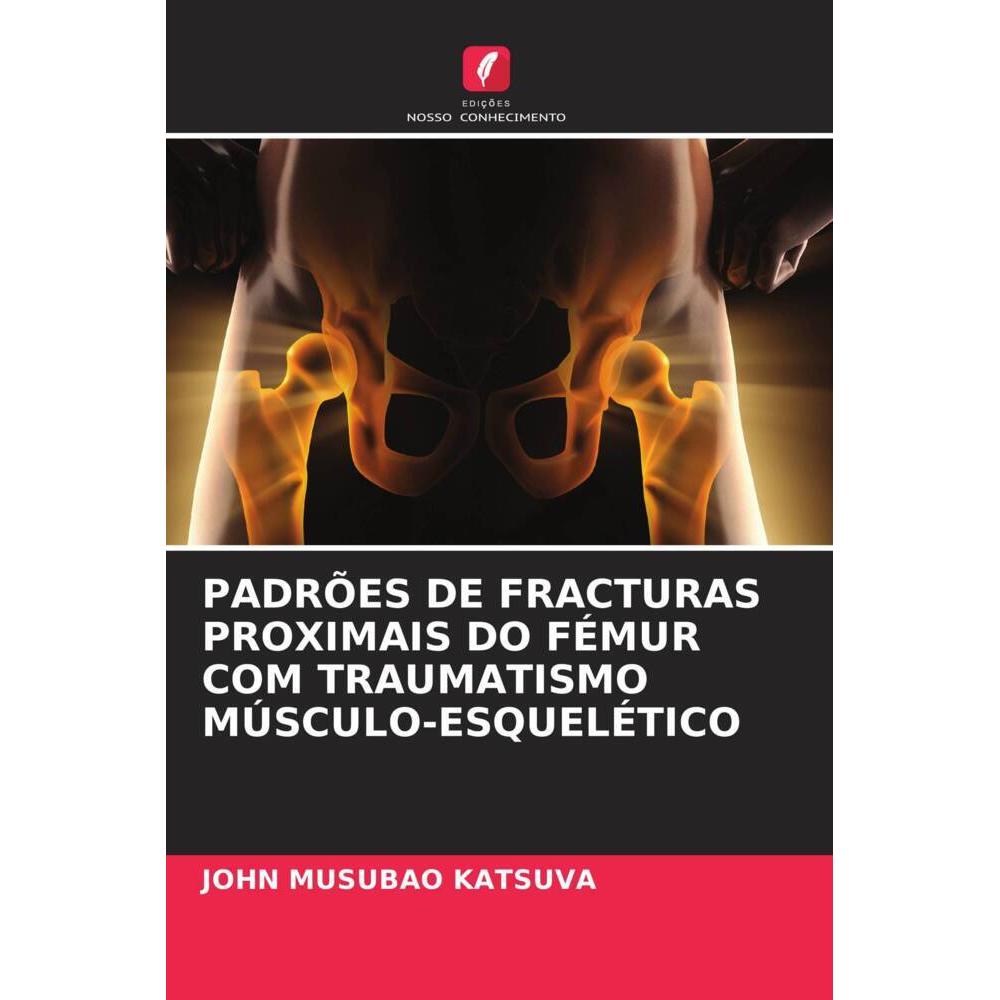 Various Publishers Padrões De Fracturas Proximais Do Fémur Com ...