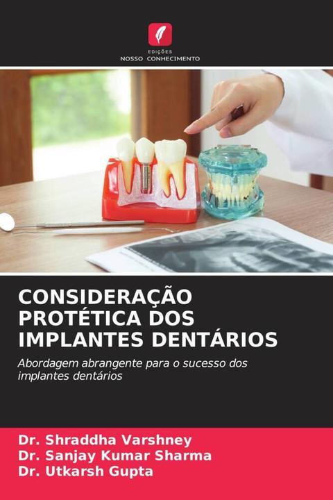 Various Publishers Consideração Protética Dos Implantes Dentários - Galaxus