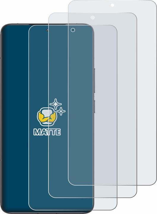 BROTECT Entspiegelungs-Schutzfolie Displayschutz Matt (6 Stk., Xiaomi ...