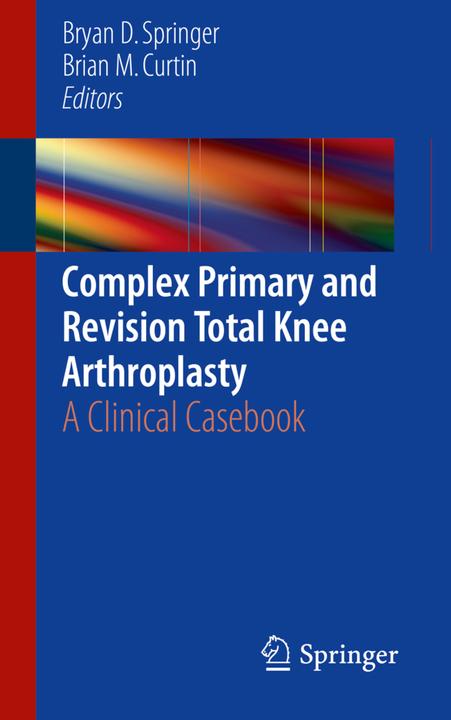 Springer Complex Primary and Revision Total Knee Arthroplasty - Galaxus