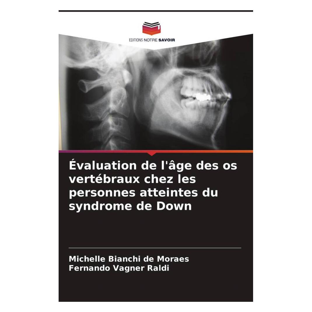 Editions Notre Savoir Évaluation de l'âge des os vertébraux chez les ...