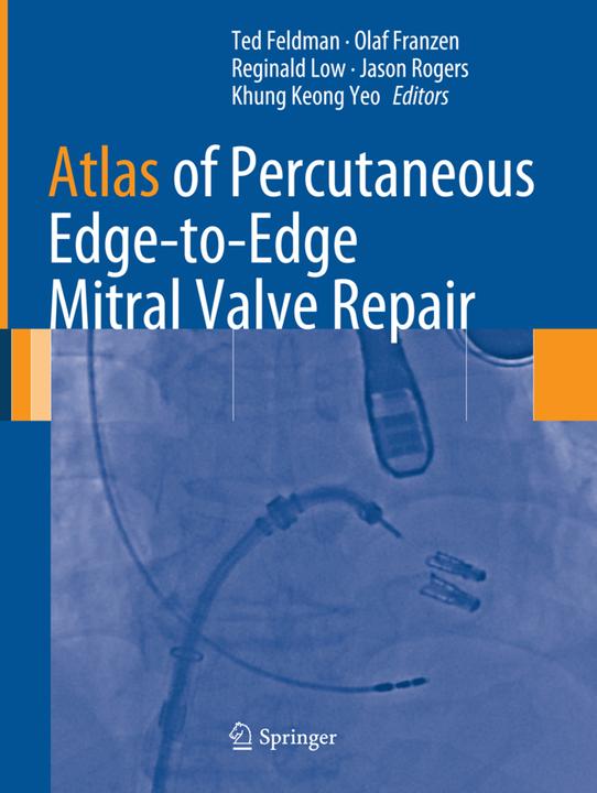 Springer Atlas of Percutaneous Edge-to-Edge Mitral Valve Repair - Galaxus