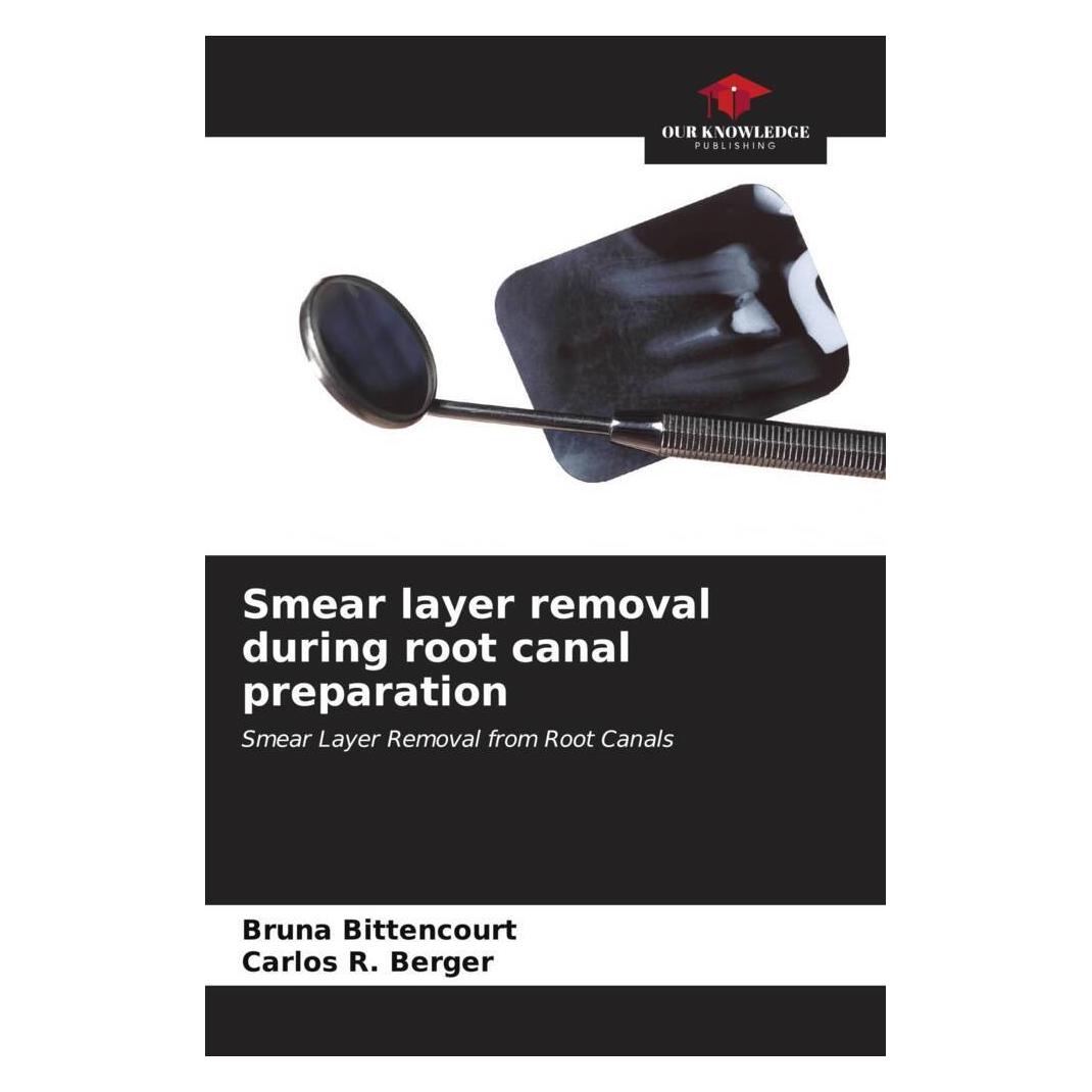 Our Knowledge Publishing Smear layer removal during root canal ...