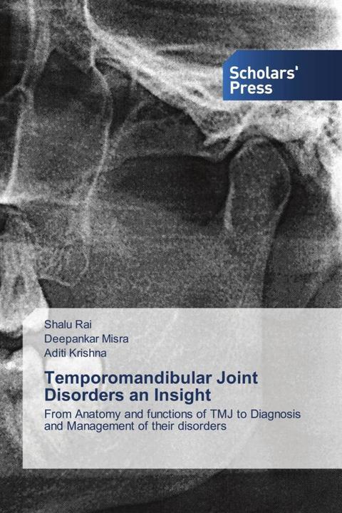Scholar'S Press Temporomandibular Joint Disorders an Insight - Galaxus