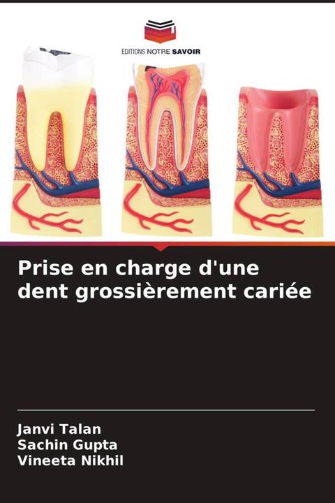 Editions Notre Savoir Prise en charge d'une dent grossièrement cariée ...