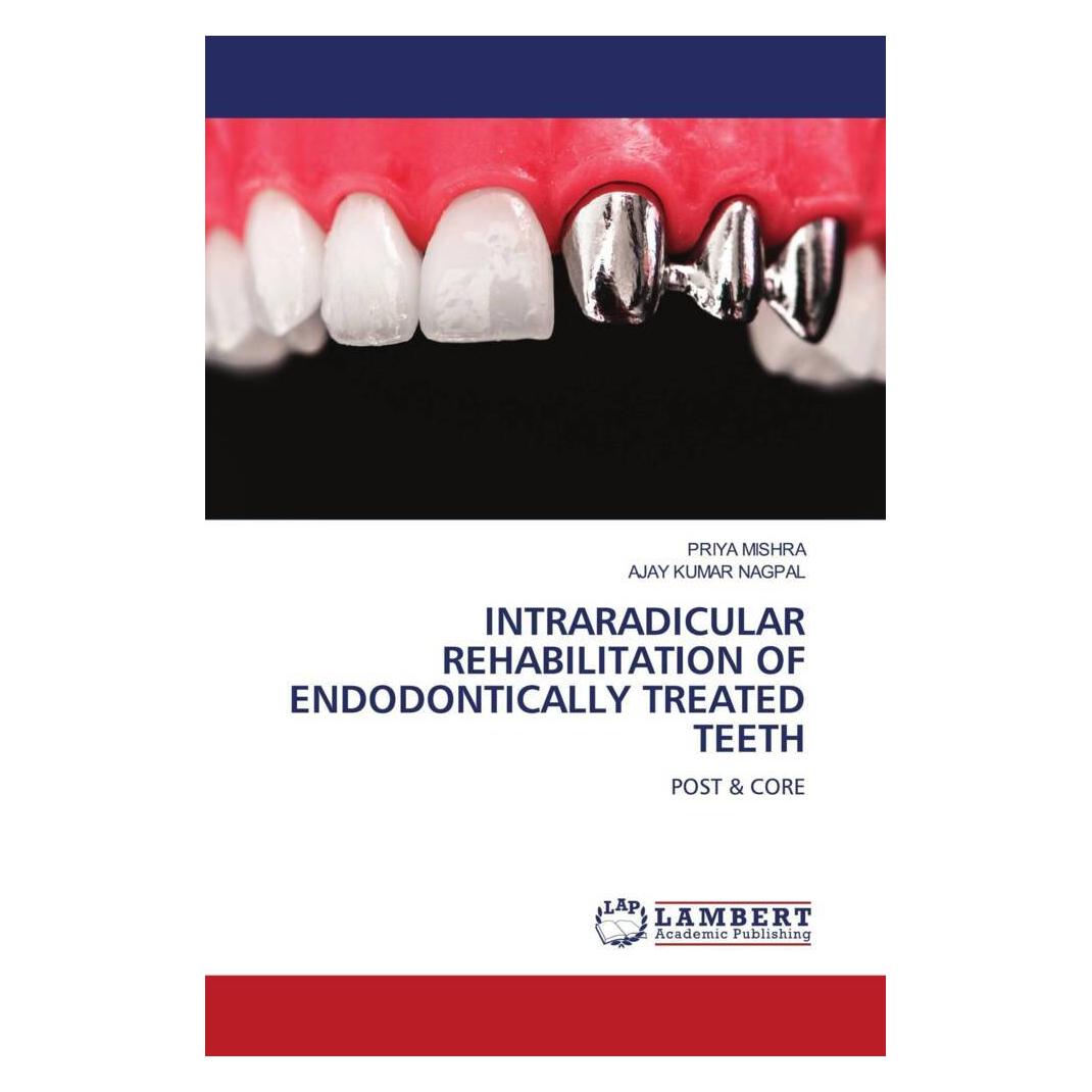 Lap Lambert Academic Intraradicular Rehabilitation Of Endodontically ...