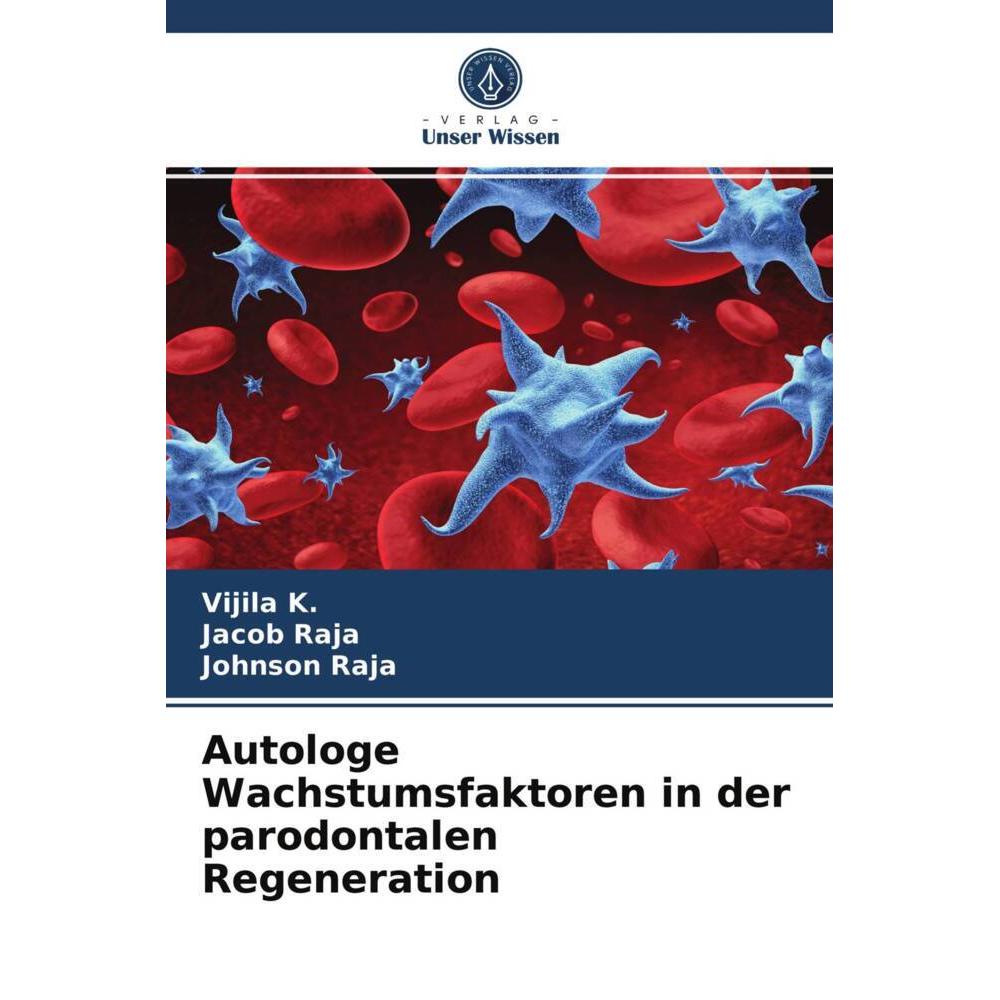 Unser Wissen Autologe Wachstumsfaktoren in der parodontalen ...