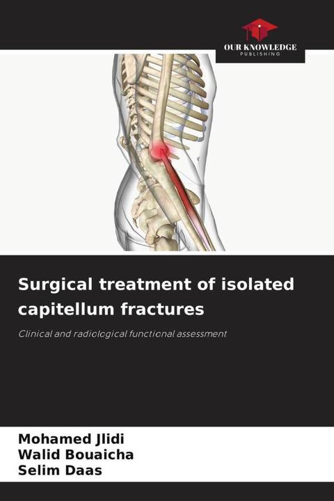 Our Knowledge Publishing Surgical treatment of isolated capitellum ...