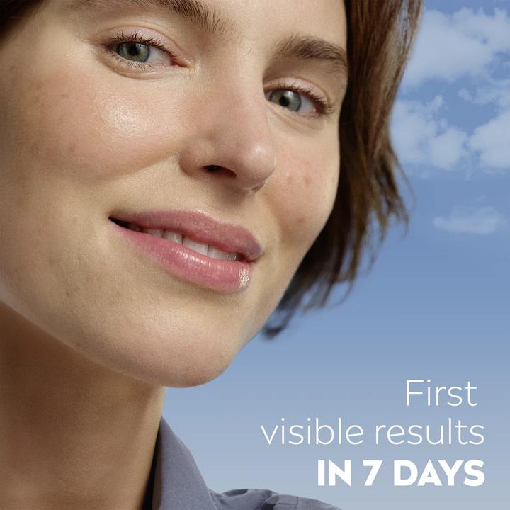 NIVEA Rejuvenating Serum Against Pigment Spots Cellular Luminous 630 ...